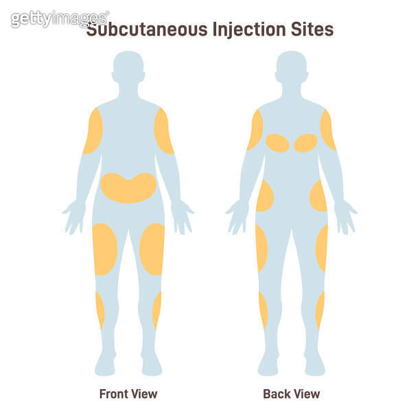 Subcutaneous injection sites. Medicine injection sites on the human ...