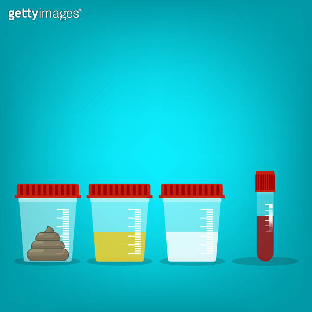 Urine, stool, sperm and blood analysis. Urine, stool, sperm and blood ...