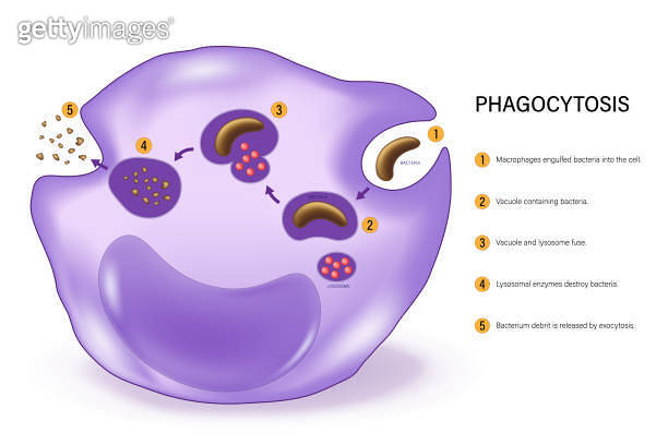 Phagocytosis vector. Process of macrophage absorption and killing of ...