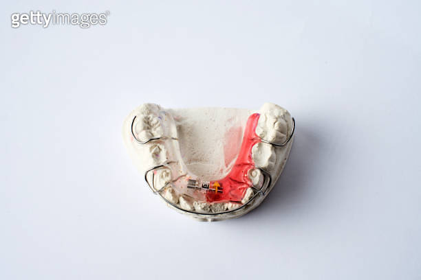 Dental Plate for Children, Retainer for teeth correction. Dental ...