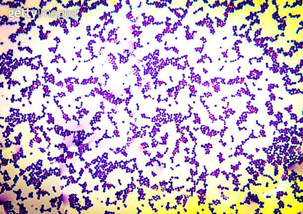 Gram positive Staphylococcus appears in cluster form under the ...