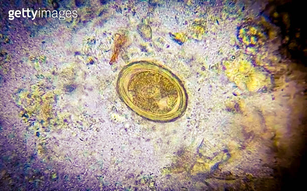 Egg of Ascaris lumbricoides roundworm in stool analyze by microscope ...