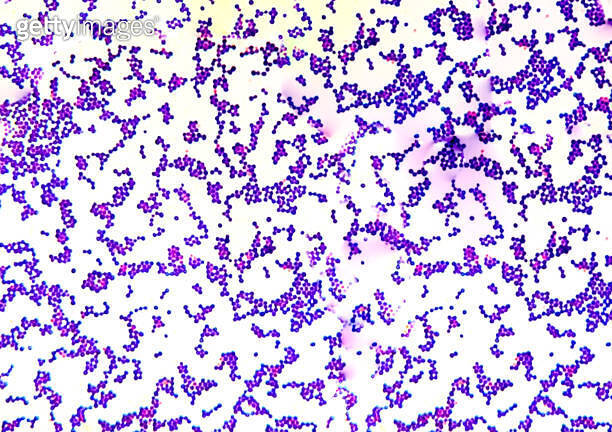 Gram positive Staphylococcus appears in cluster form under the ...