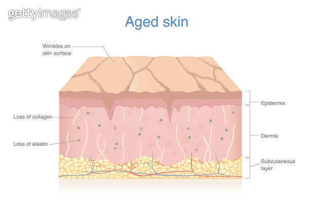 Aged skin layer isolated on white. Wrinkles and dryness on skin surface ...