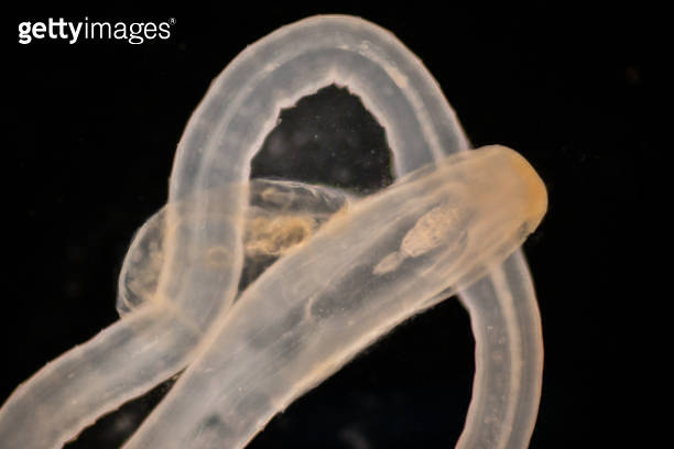 Cyctacanth stage (Acanthocephala) fish cestode larva (Trianchoratus sp ...