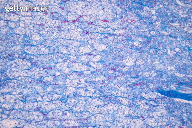 Showing Light micrograph of the Adrenal gland, Spleen human and Other ...
