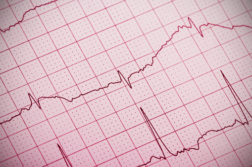 Close up of a Electrocardiograph also known as a EKG 이미지 (594948498 ...